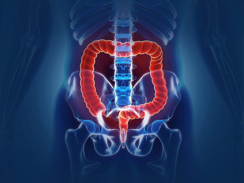 Virtual Colonoscopy | LifeGenix Institute | Dallas, TX